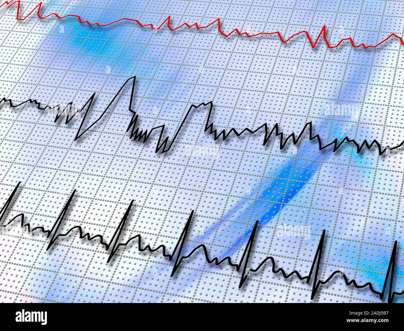 Irregular heartbeat. Computer artwork of an electrocardiogram (ECG ...