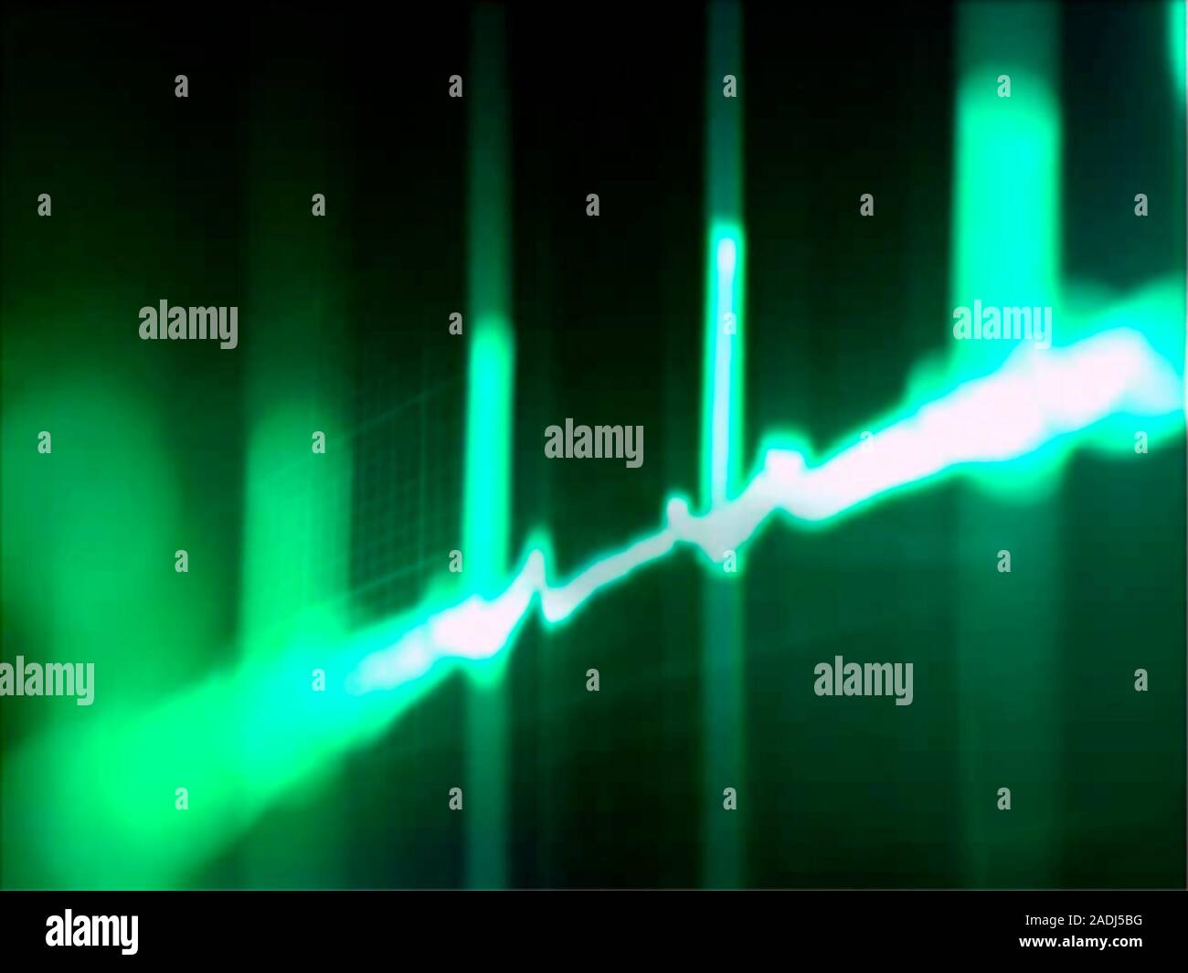 ECG. Computer artwork of an electrocardiogram (ECG) showing a normal ...