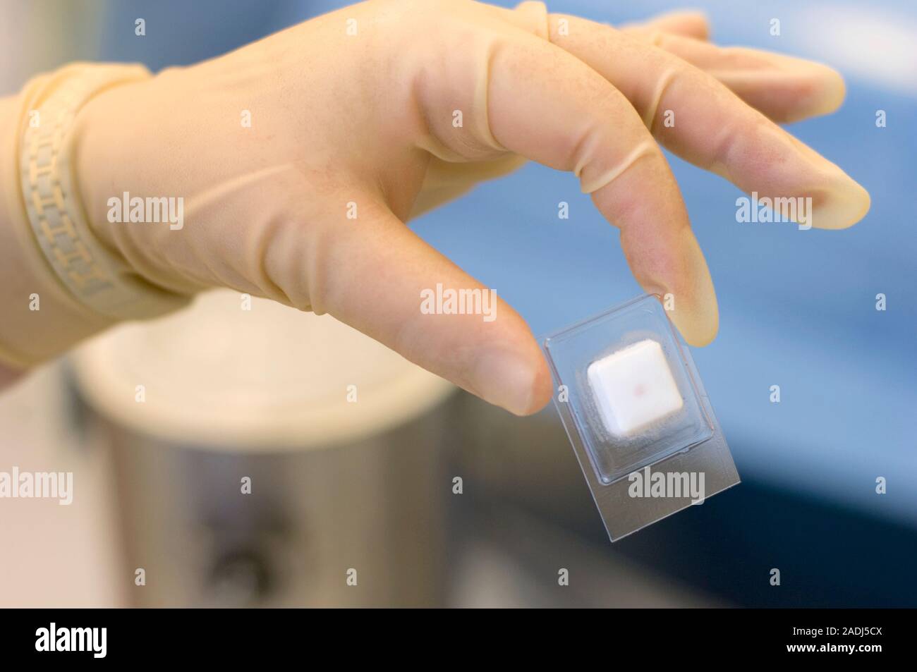 Biopsy tissue storage. Gloved hand holding a frozen tissue sample ...