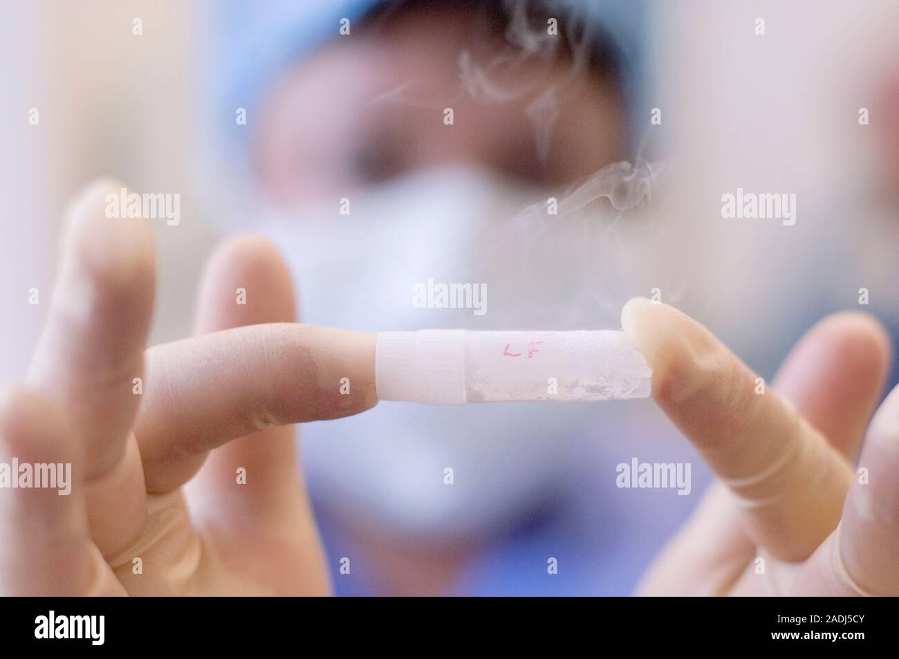 Biopsy tissue storage. Surgeon holding a container that contains a ...