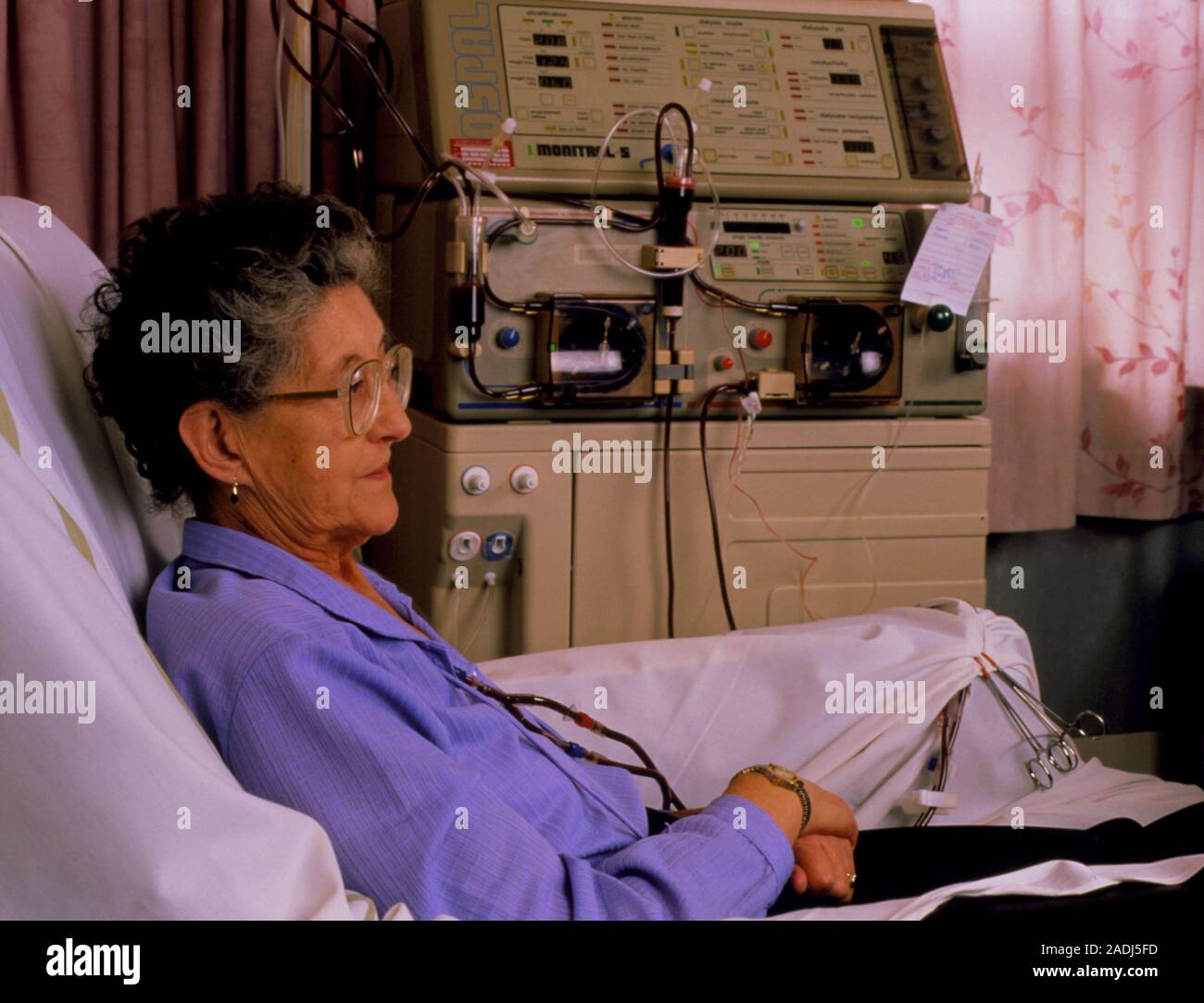 Female patient using a kidney machine to undergo renal dialysis. A ...