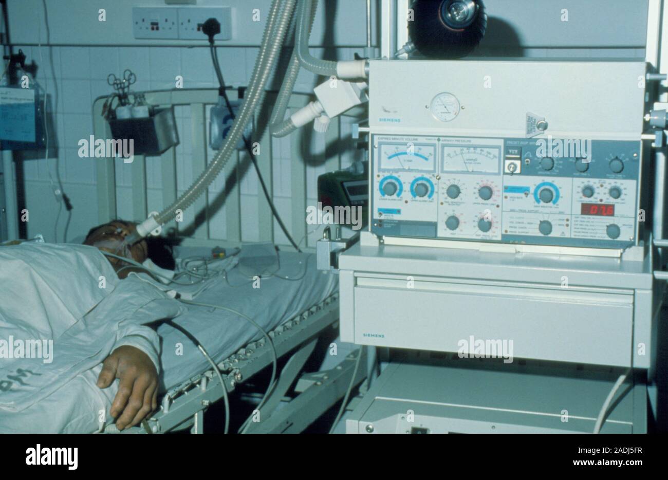 Brain death. Brain-dead patient on a life-support system. Brain death ...