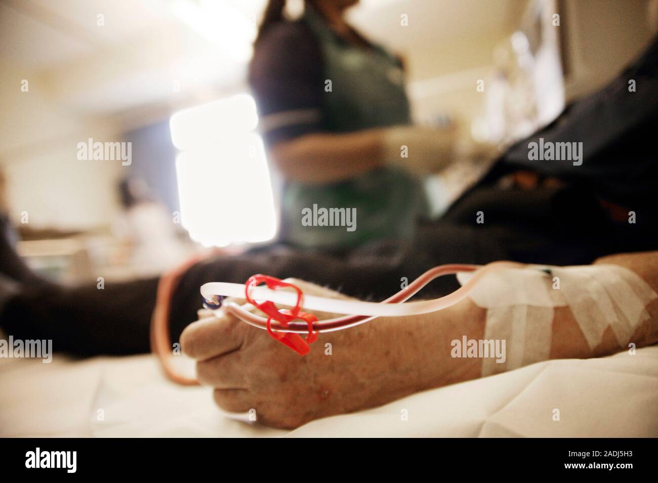 Kidney dialysis. Blood (red) flowing down a tube from the forearm of a ...