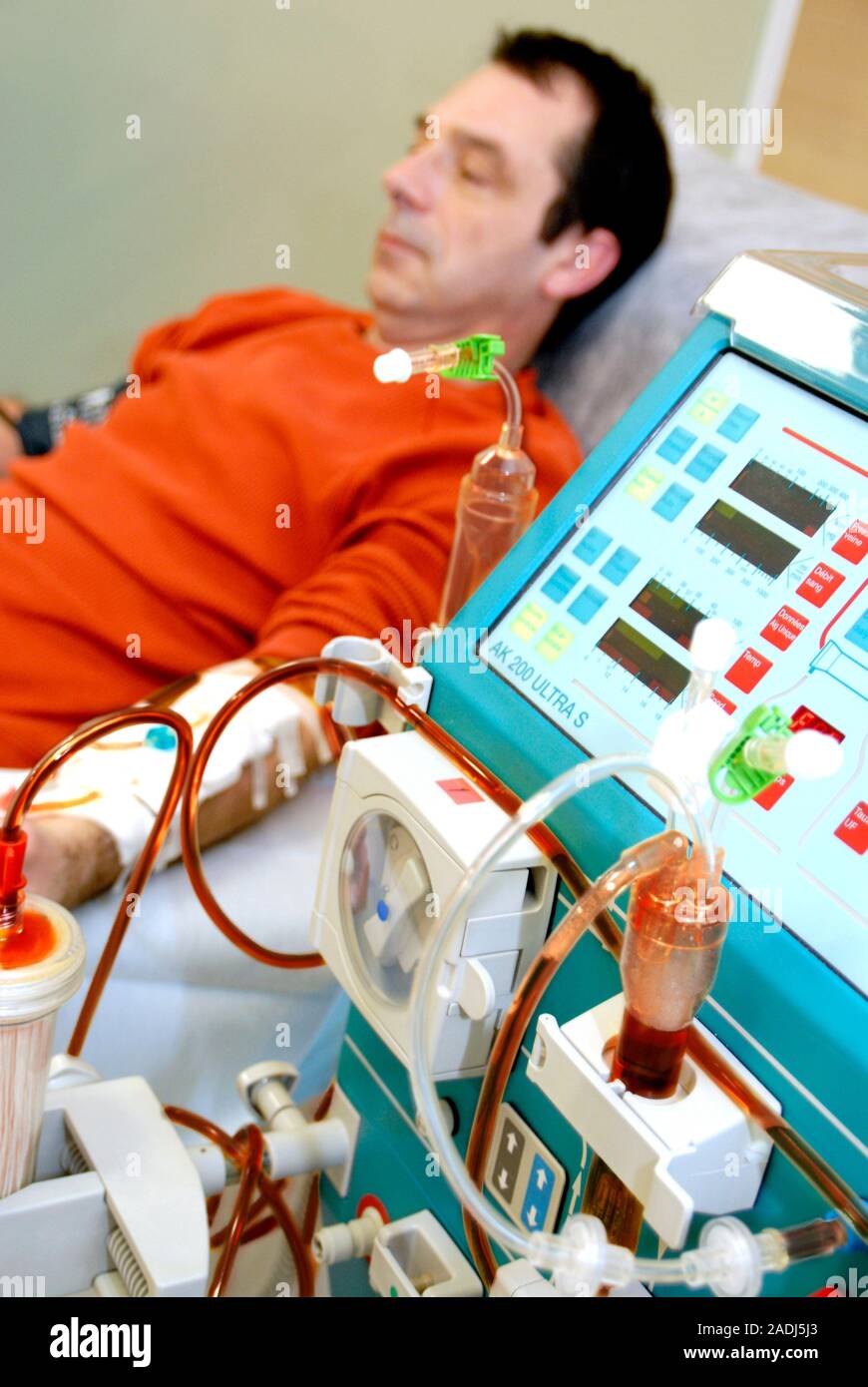 Dialysis unit. Patient in a dialysis treatment unit. Kidney dialysis ...