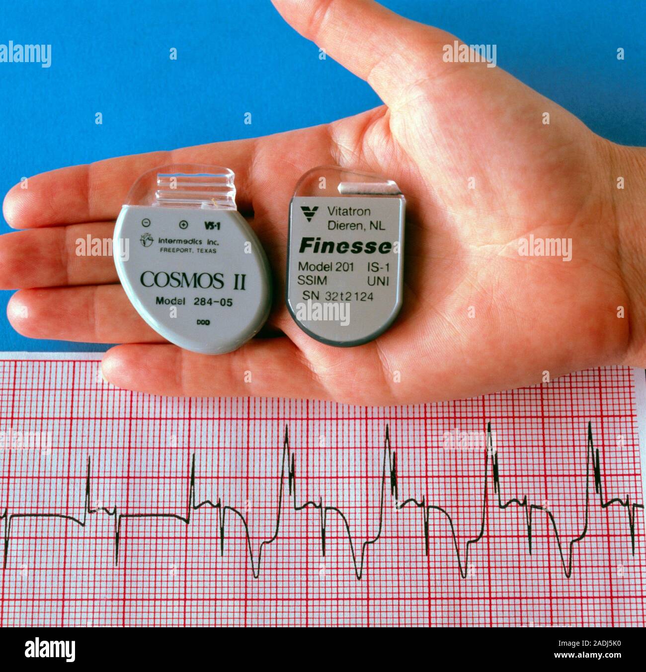 Pacemakers. Hand holding pacemakers underneath which is a normal ...