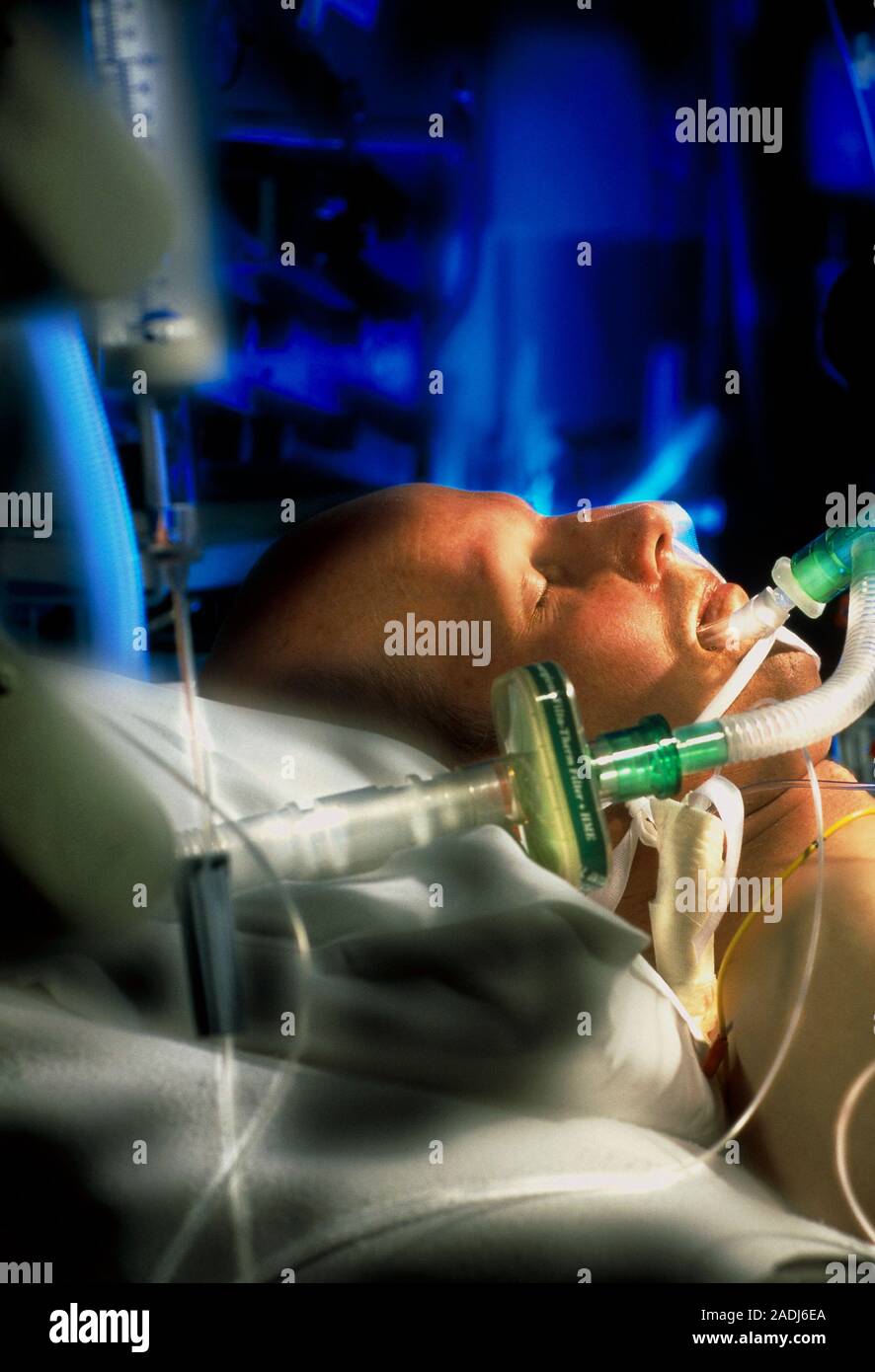 Cardiac intensive care. View of a male patient having undergone heart ...
