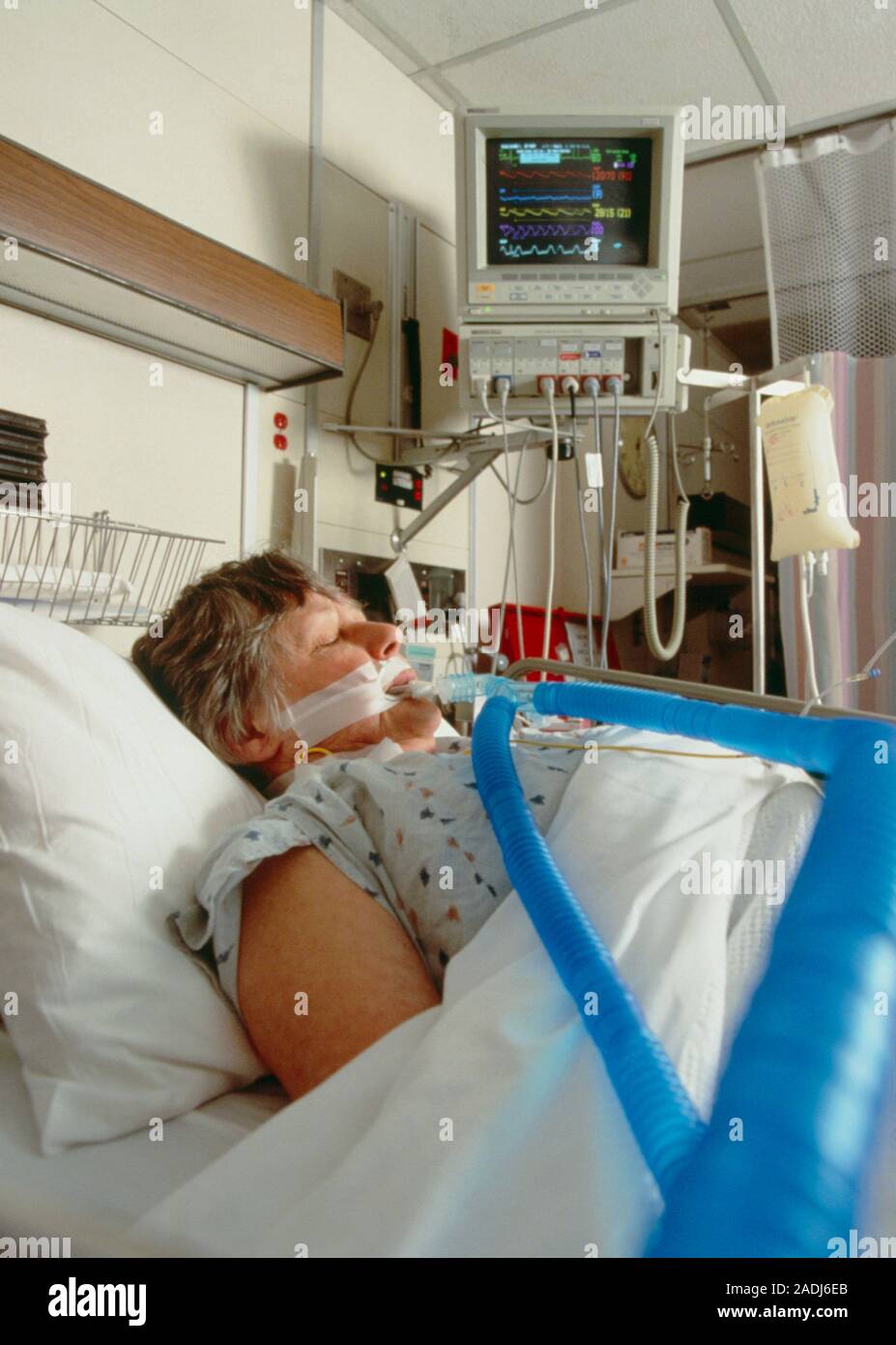 Intensive care. Elderly woman on a respirator in a hospital intensive ...