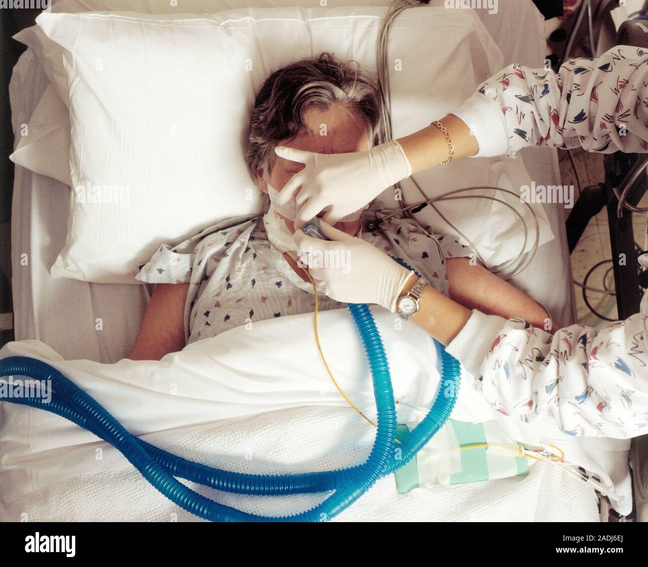 Life support removal. Nurse removing a respirator from a female patient ...