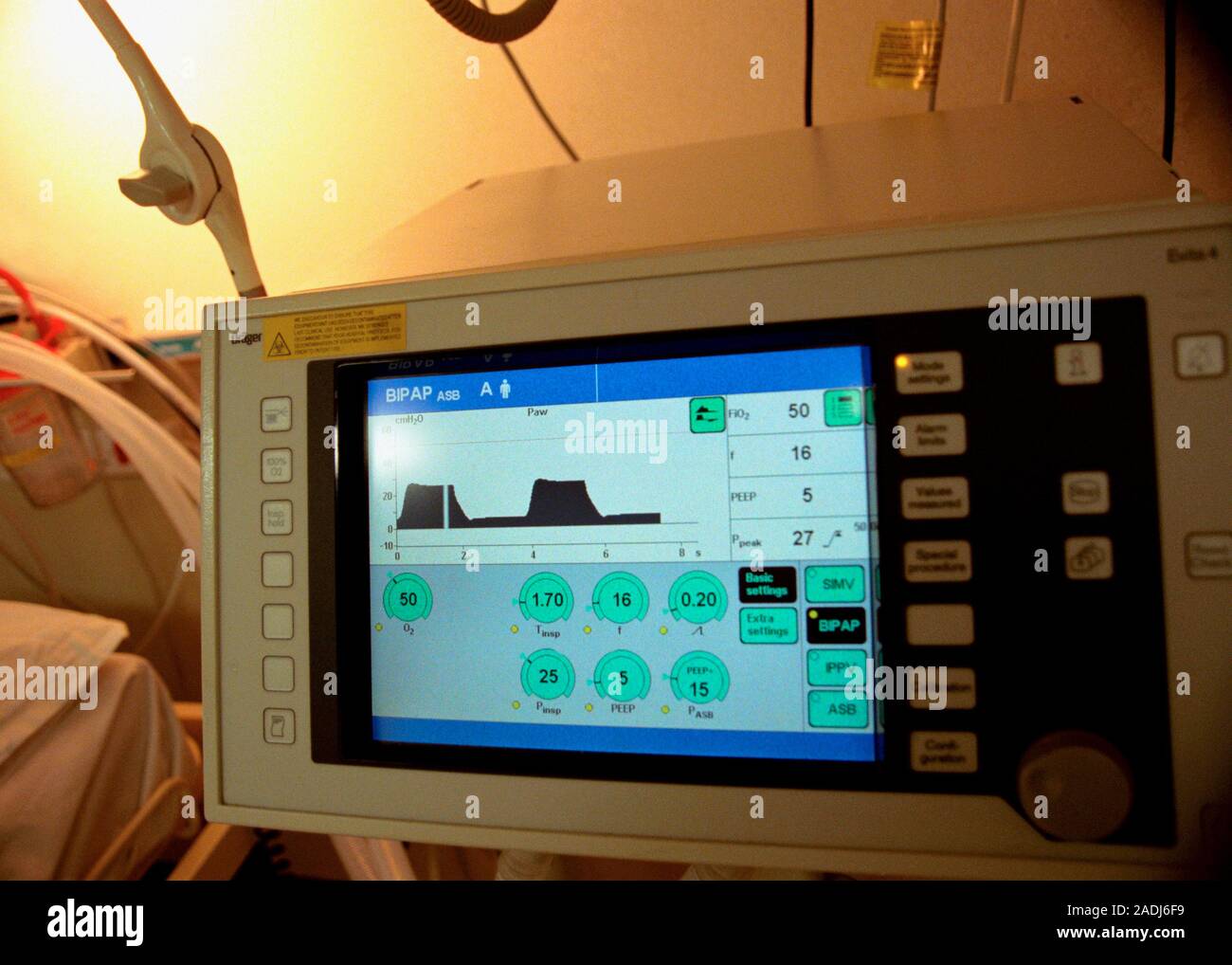 Ventilator monitor in an intensive care unit. This machine is ...