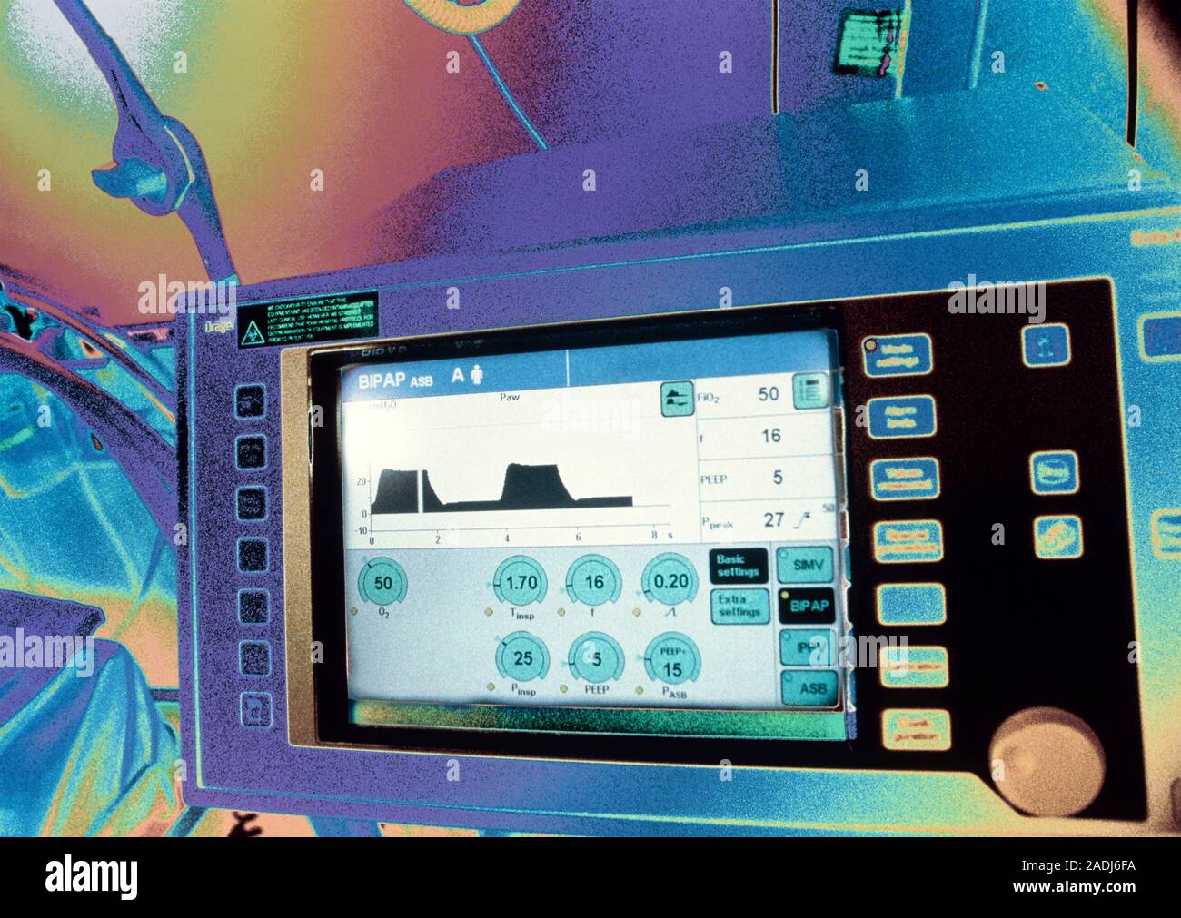 Ventilator monitor. Computer-enhanced image of a ventilator monitor in ...