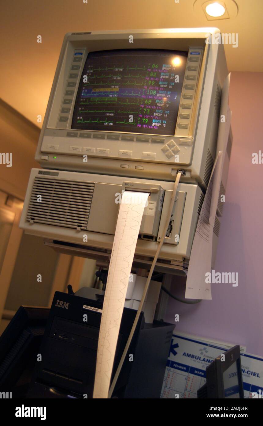 Vital signs monitor in a hospital intensive care unit (ICU). The ...