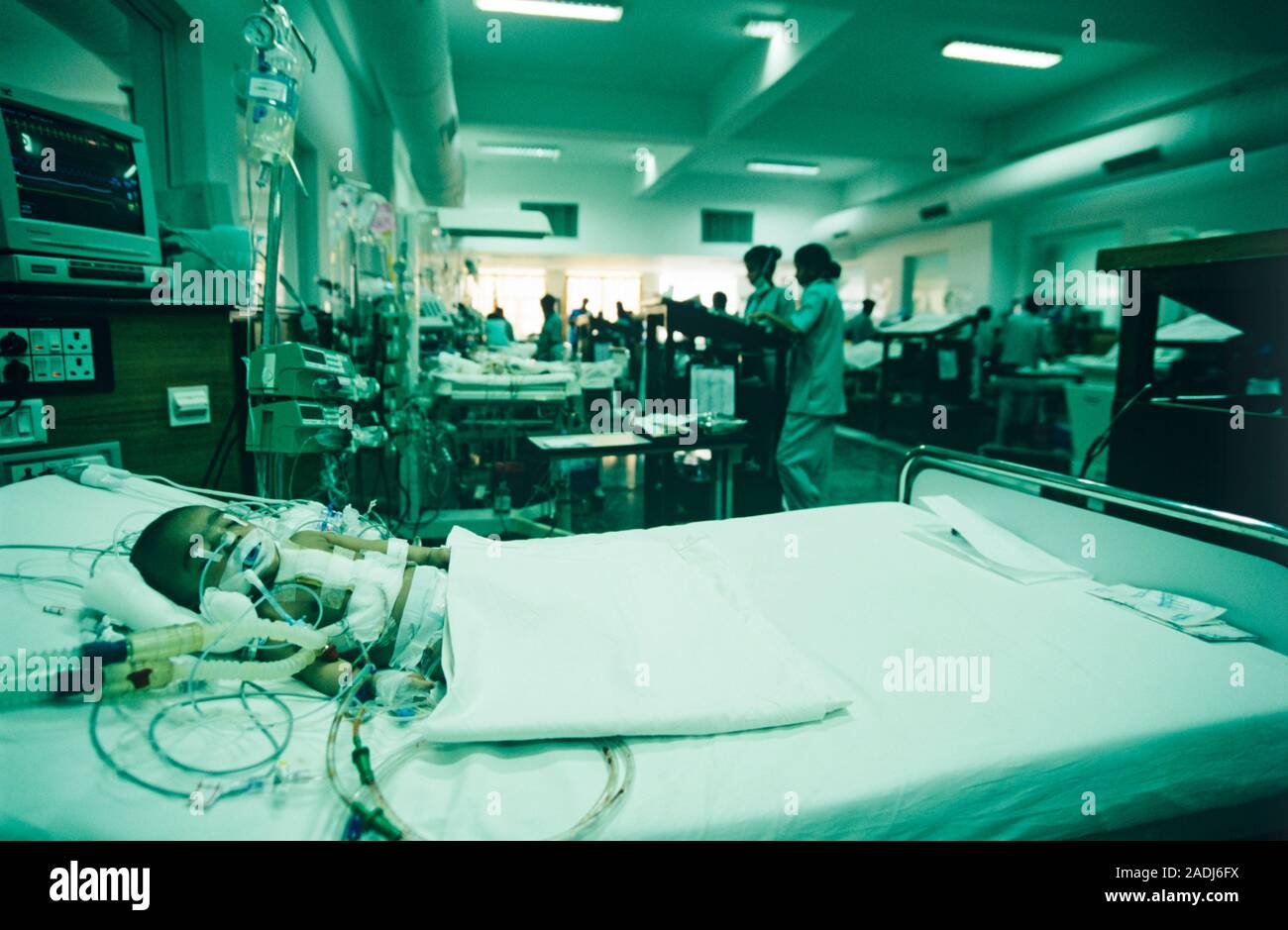 Heart surgery patient. Baby in an intensive care ward after having open ...