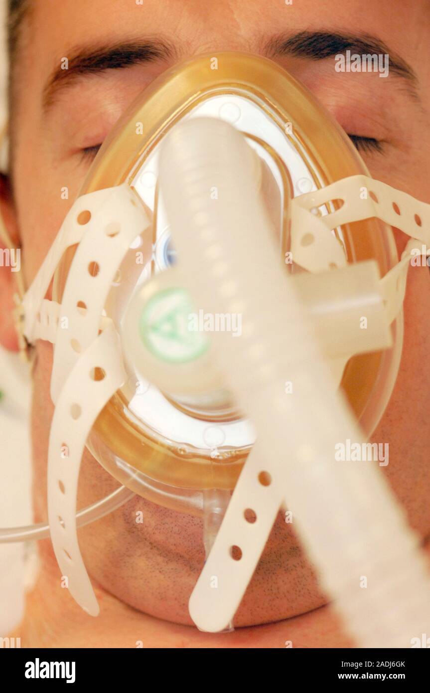MODEL RELEASED. Intensive care patient. Face of a male patient in the ...