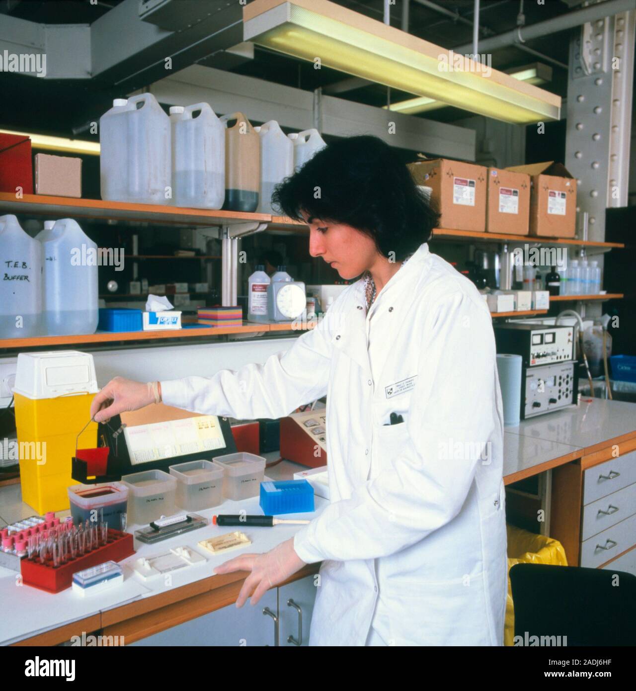 Screening blood for sickle cell disease & thalassaemia. Hospital ...