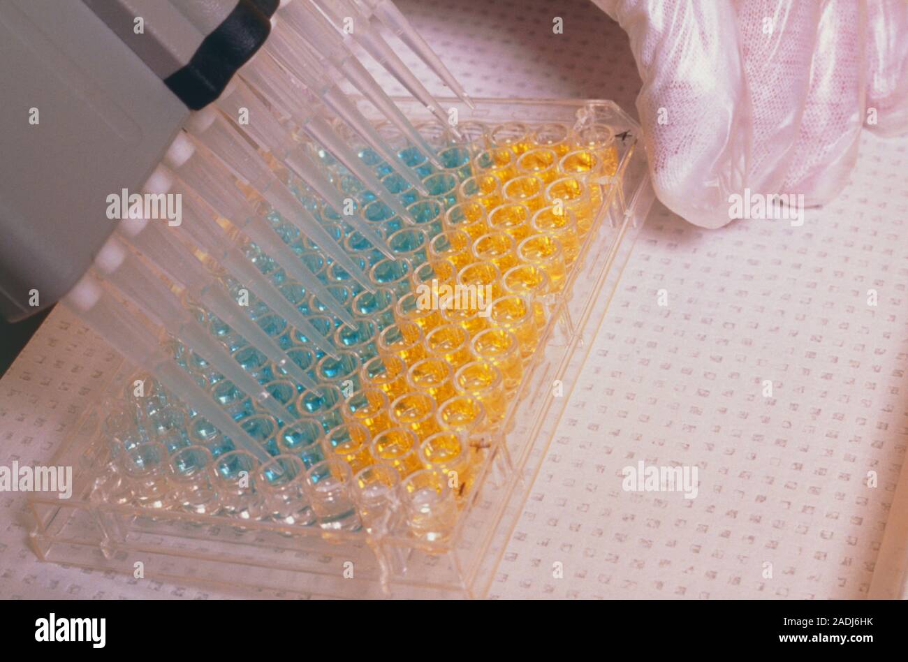 AIDS virus antibodies test: technician performing an ELISA (enzyme ...