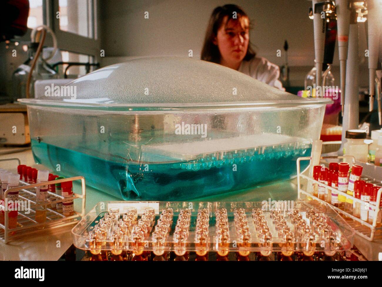 Hepatitis C ELISA" test. Technician tests human blood serum for ...