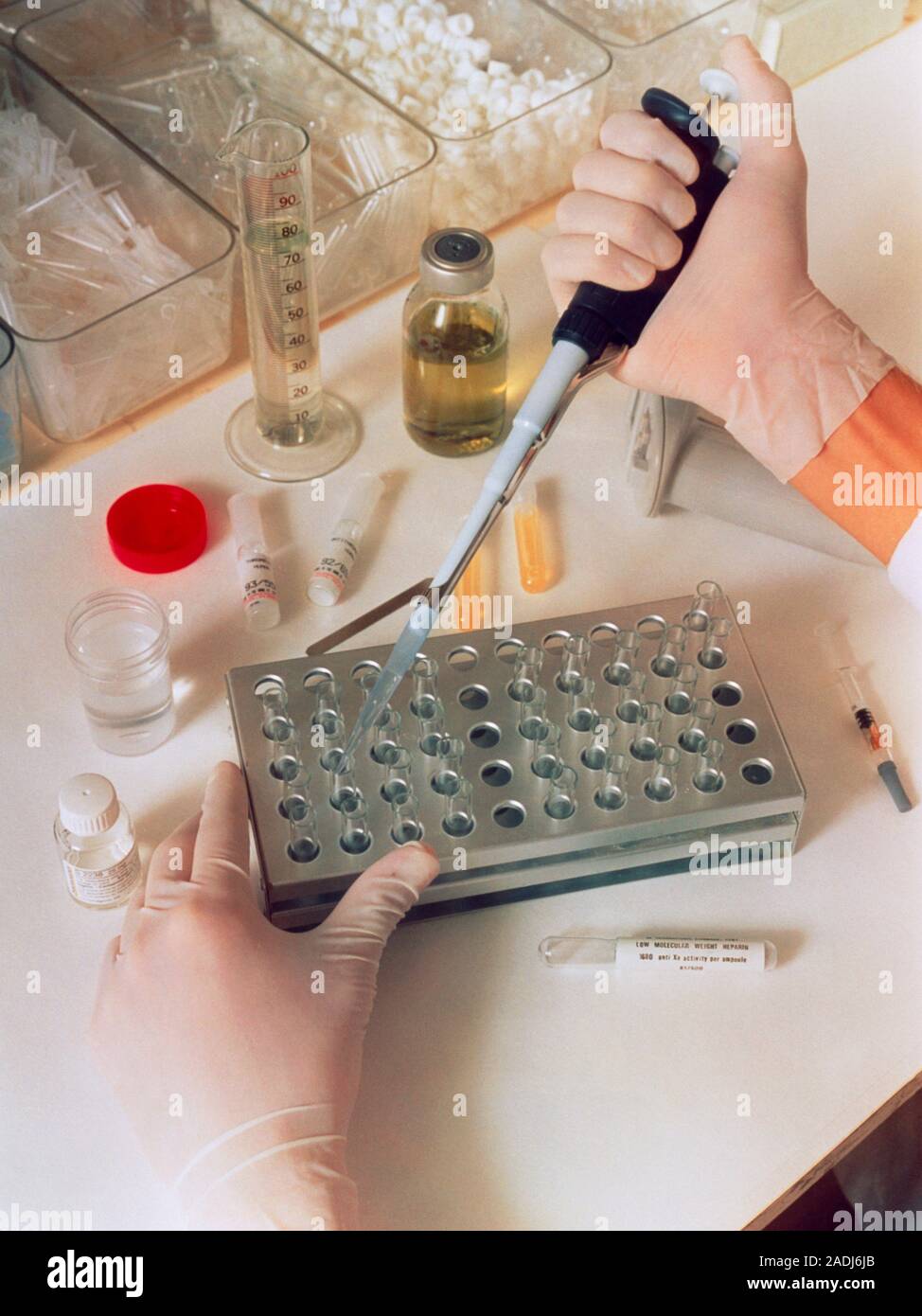 Blood heparin research. Researcher uses a pipette in diluting samples ...