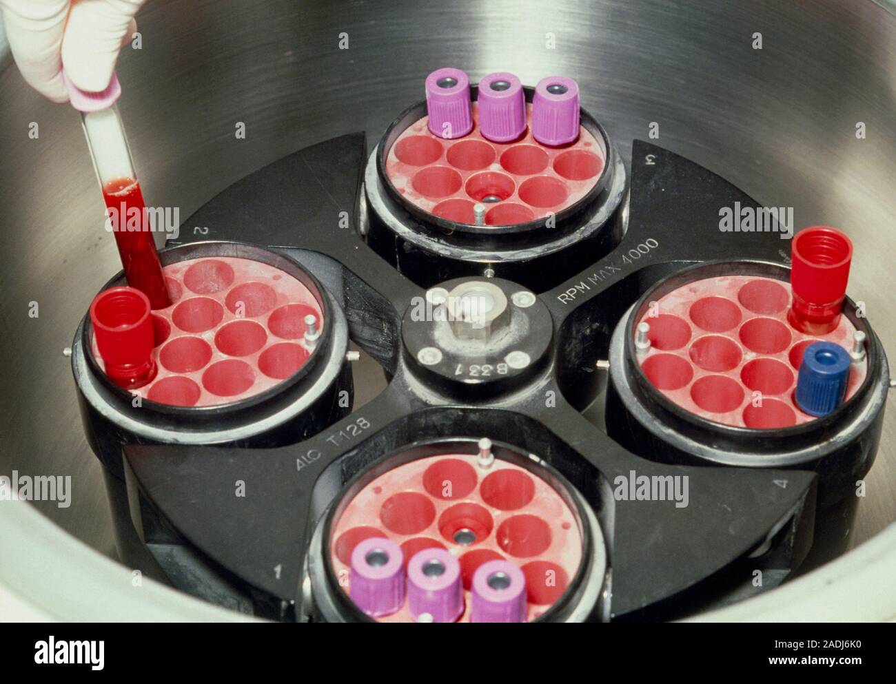 Blood centrifuge. Blood samples in sealed test tubes being loaded into ...
