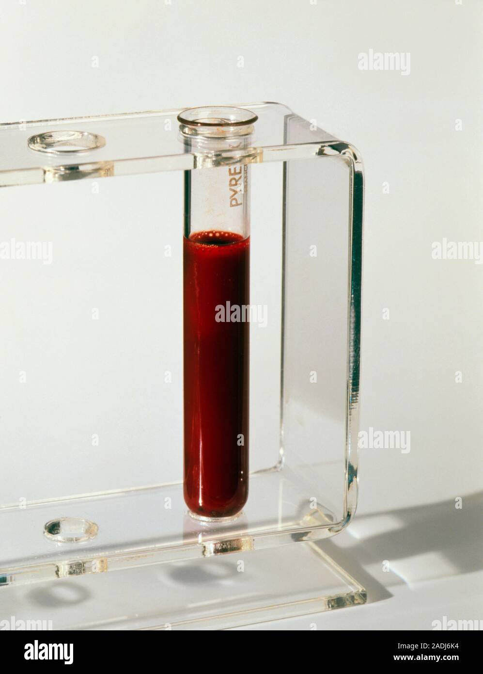 Blood sample for analysis. Sample of blood in a test tube ready for ...