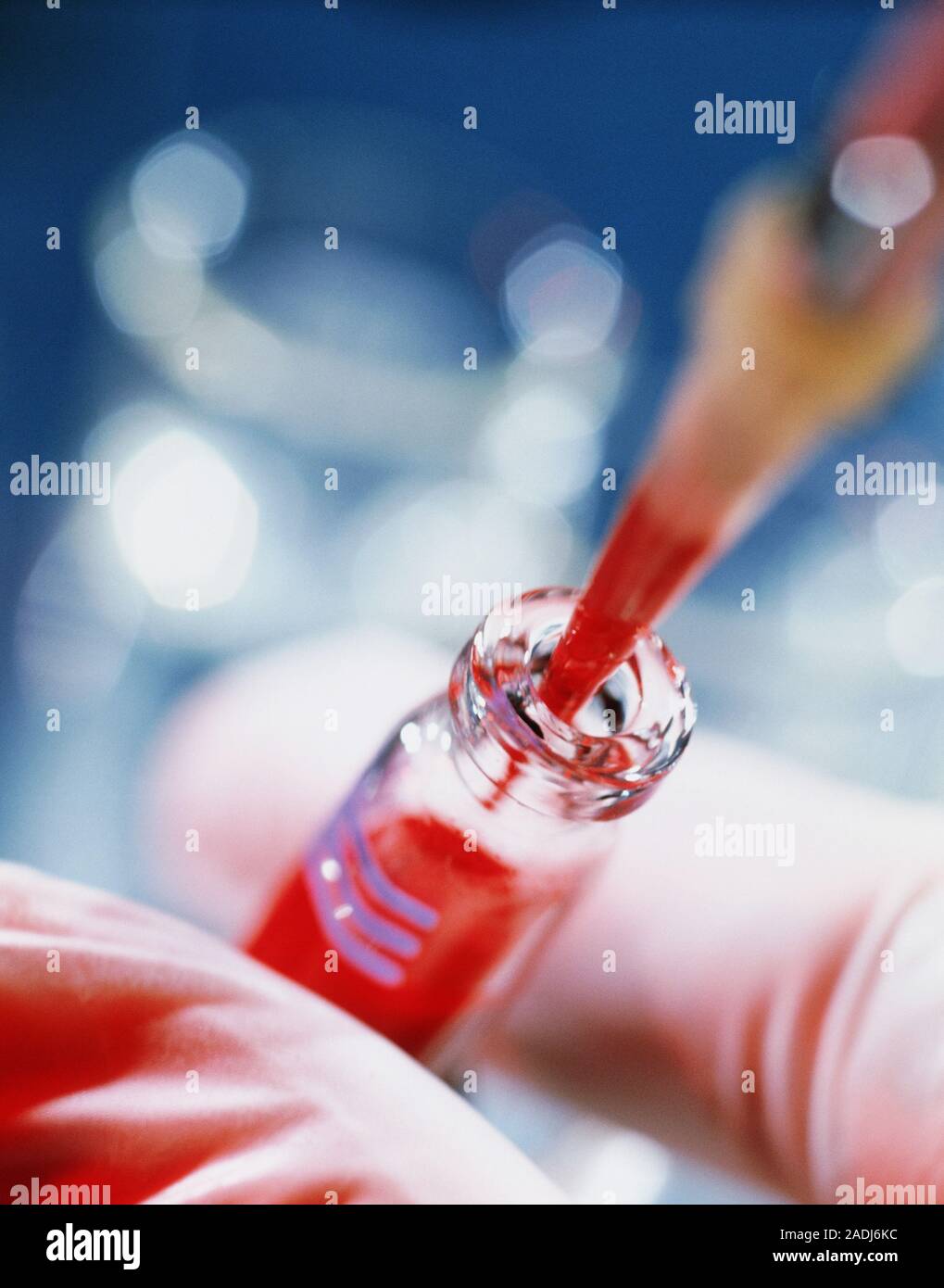 Blood analysis. View of a gloved hand using a pipette to transfer blood ...