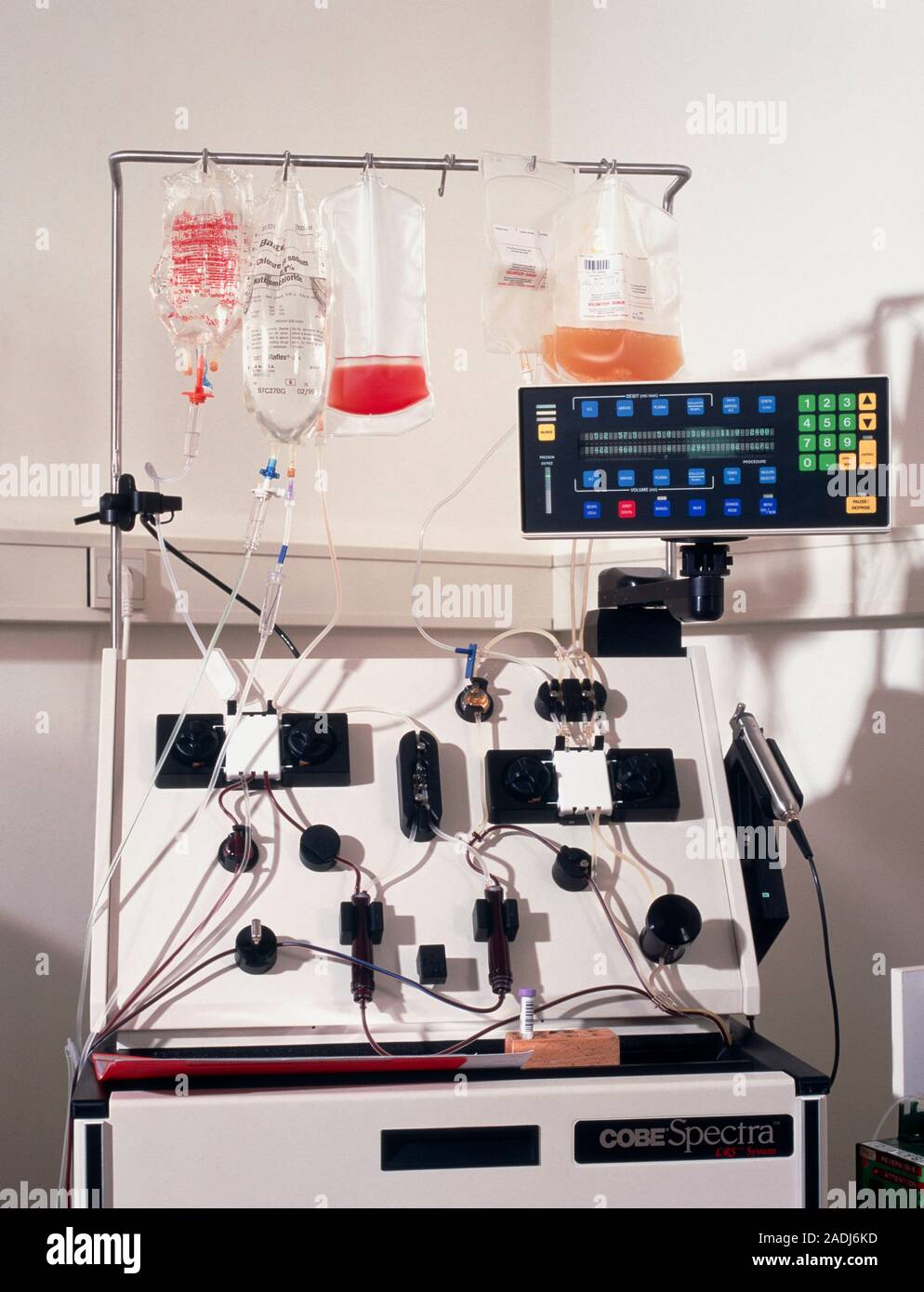 Apheresis machine. View of an apheresis (blood separation) machine ...