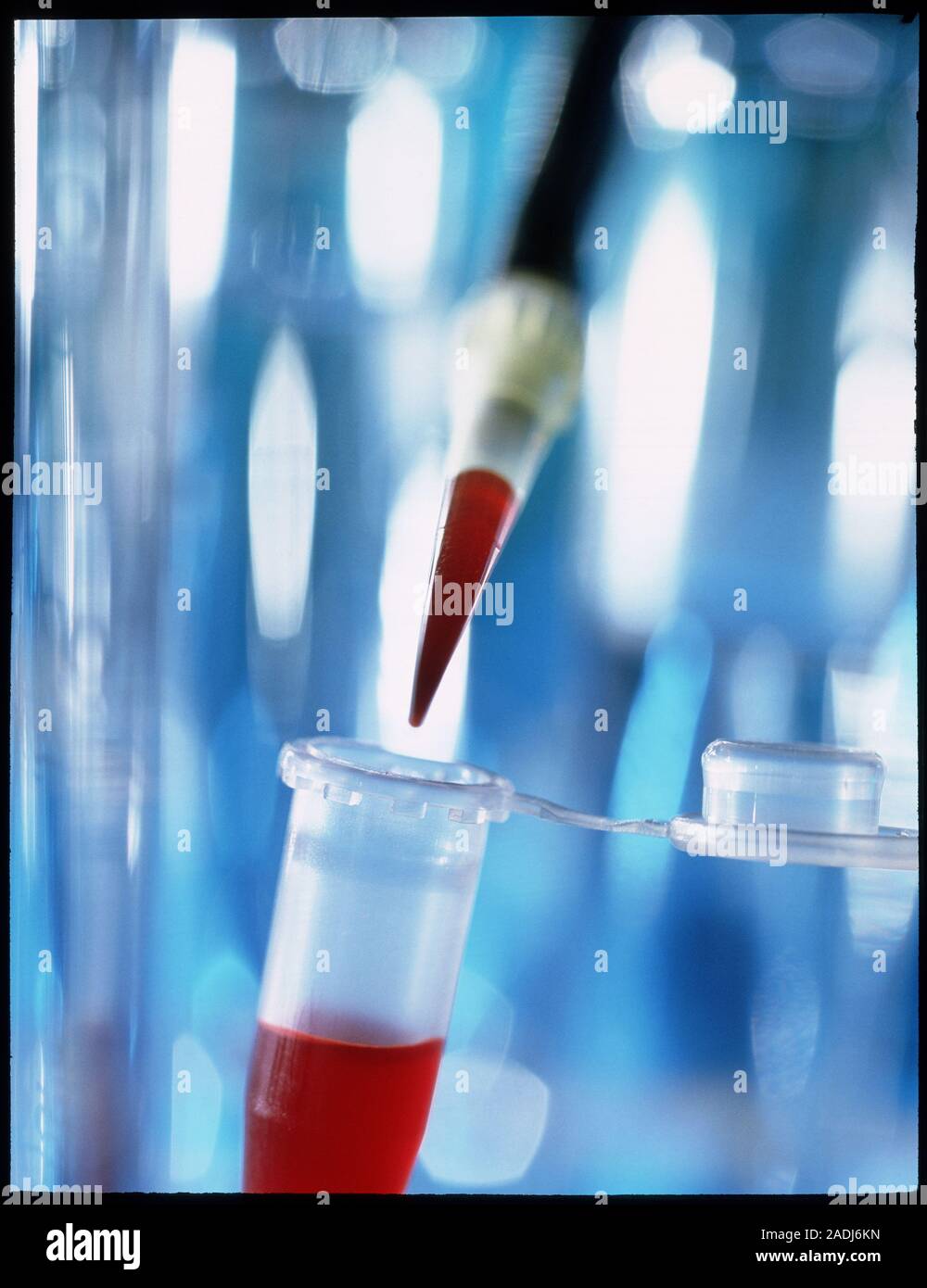 Blood analysis. View of a pipette being used to transfer blood into a ...