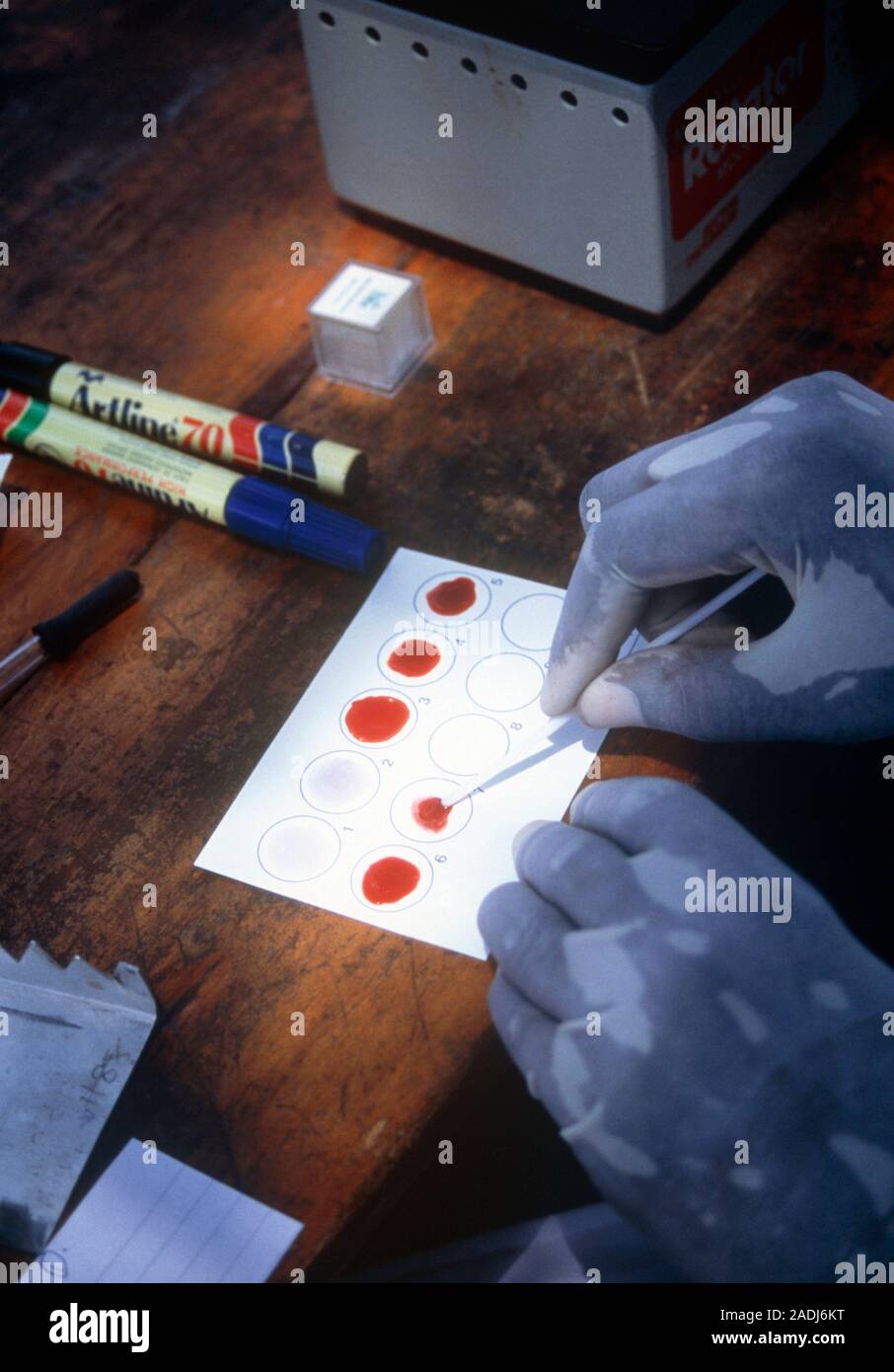 Sleeping sickness test. Technician carrying out a CATT (card ...