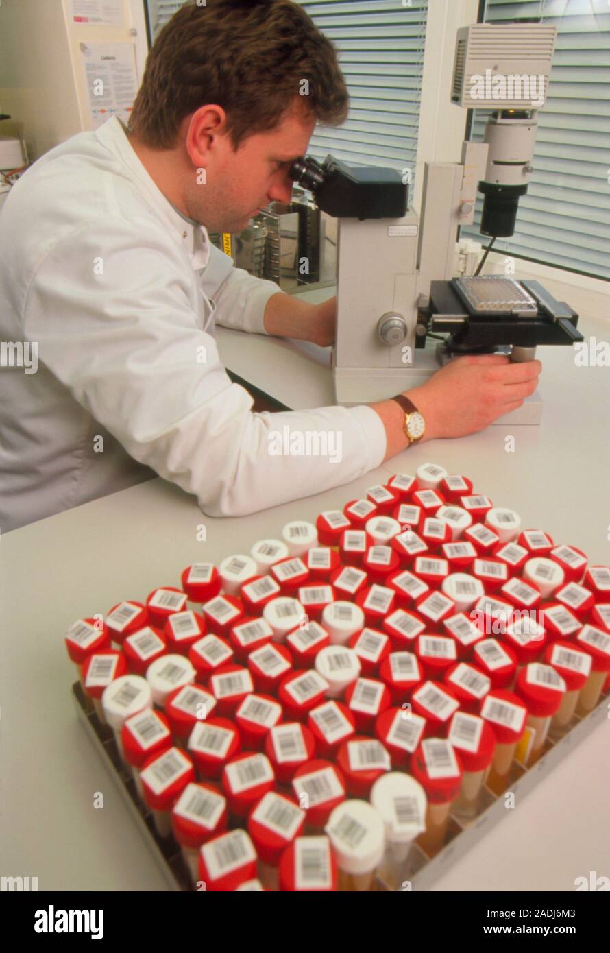 Urine blood cell examination. Male technician using an optical ...