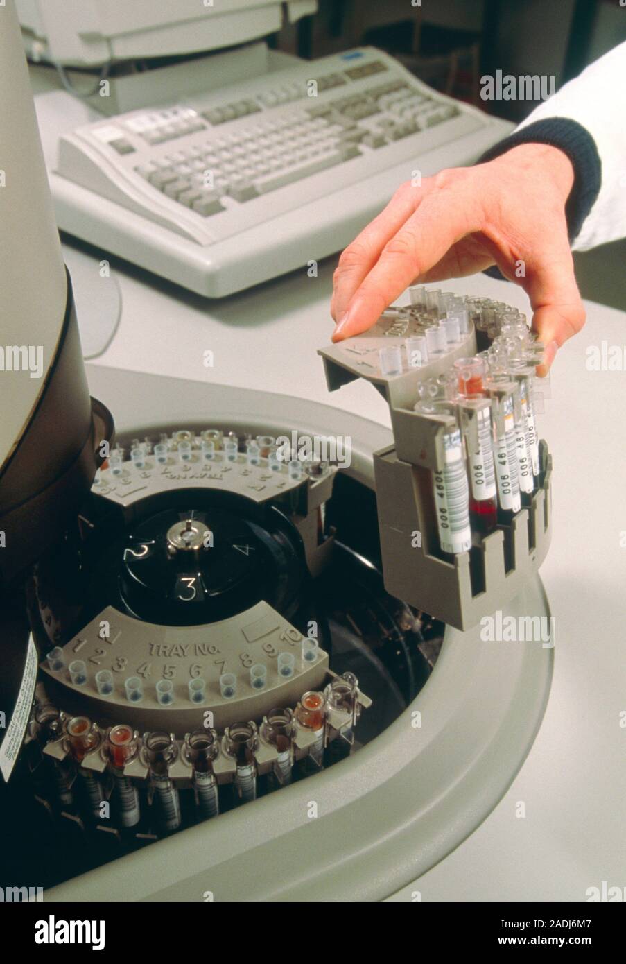Blood analysis. Hand loading blood samples into a Vitros Analyser for ...