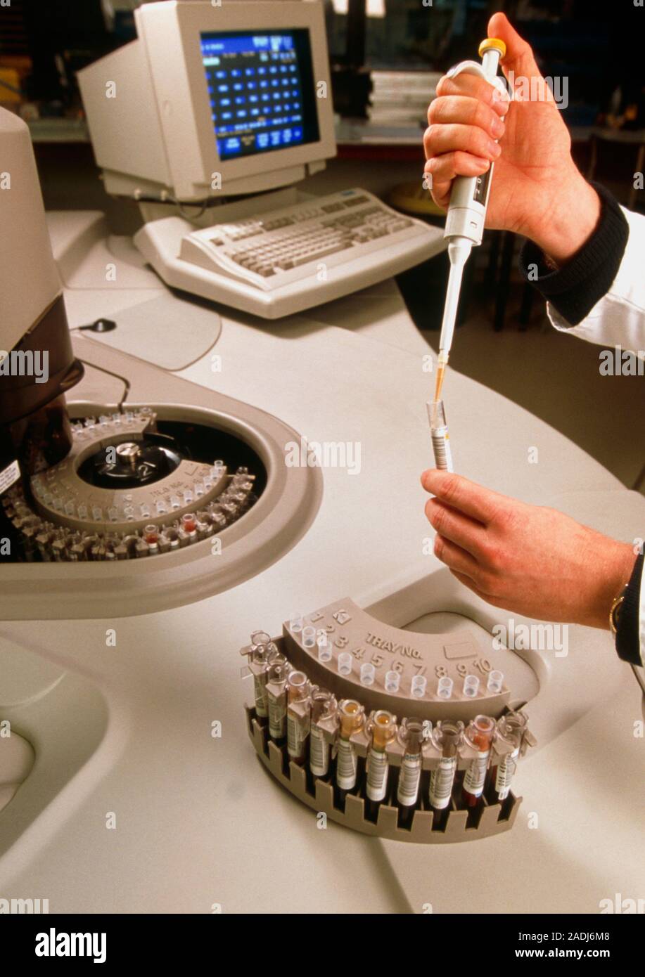 Blood analysis. Hands pipetting blood into a sample tube before ...