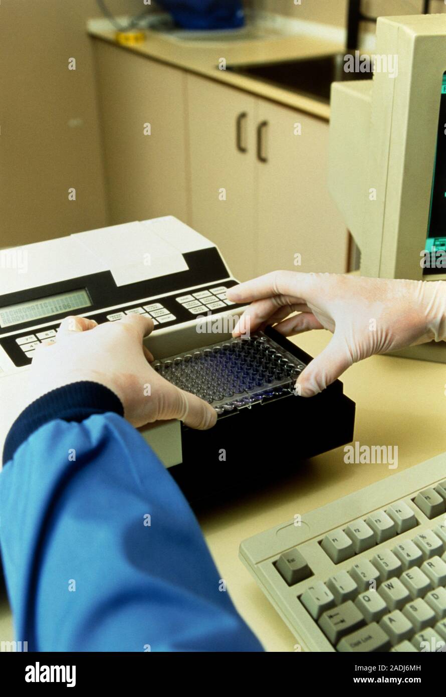 AIDS blood test. Gloved hands placing a multi-well sample tray ...