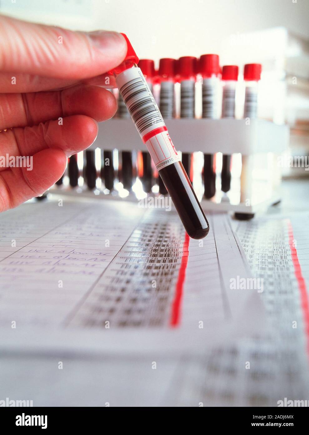 Blood samples. Hand holding a sample tube containing donated blood for ...