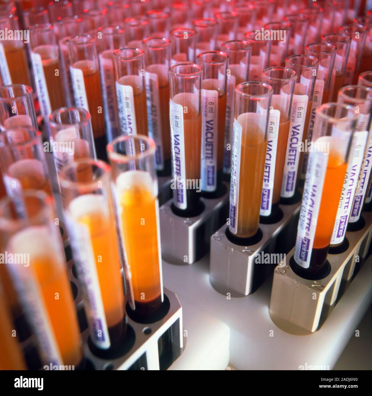 Blood samples. Rows of sample tubes containing donated blood. The blood ...