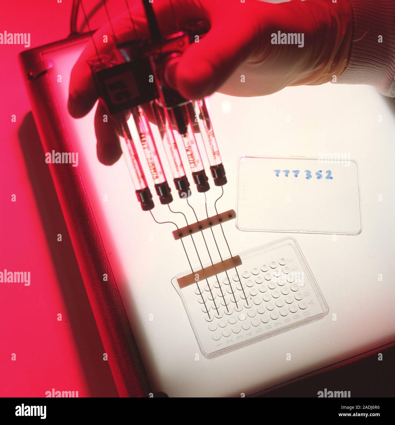 Umbilical cord blood testing. Gloved hand testing white blood cells ...
