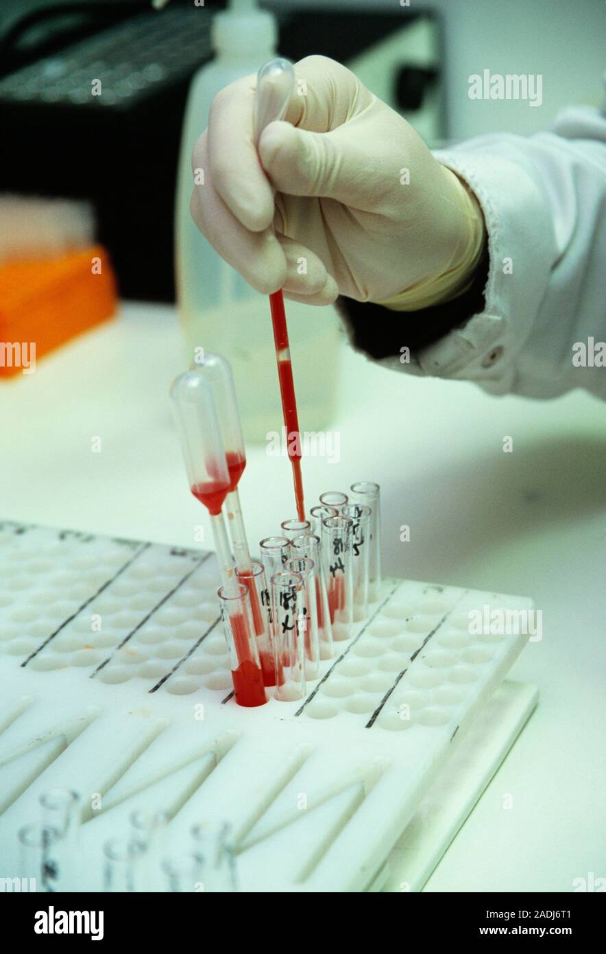 Blood group test. Technician using a pipette to mix antibodies with ...