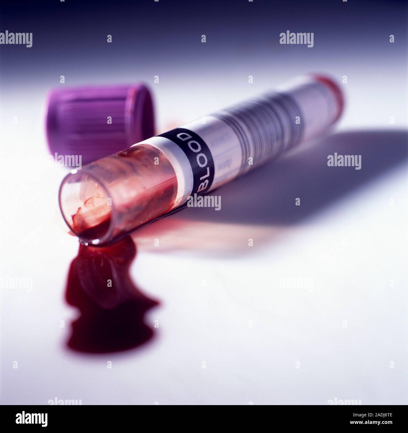 Spilled blood sample. Blood is analysed to: monitor levels of its ...