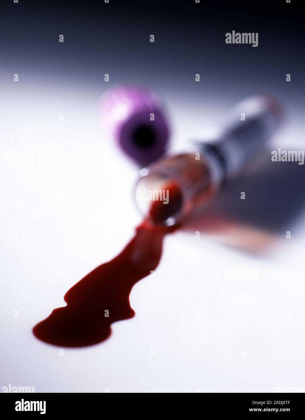Spilled blood sample. Blood is analysed to: monitor levels of its ...