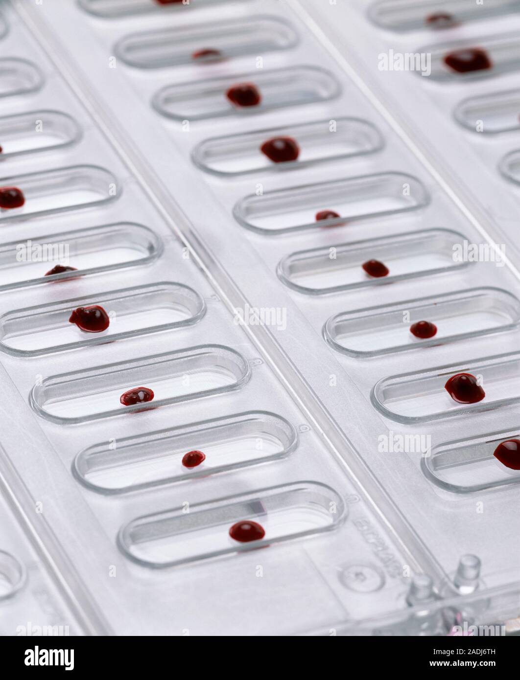 Blood group test. Image 1 of 4. Row of blood drops about to be tested ...