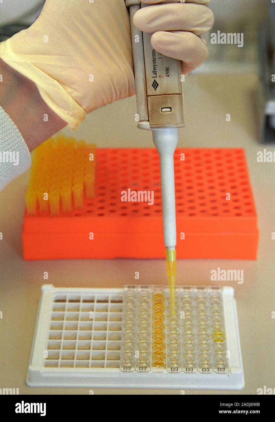 ELISA test plate. Technician using a pipette to transfer blood serum ...