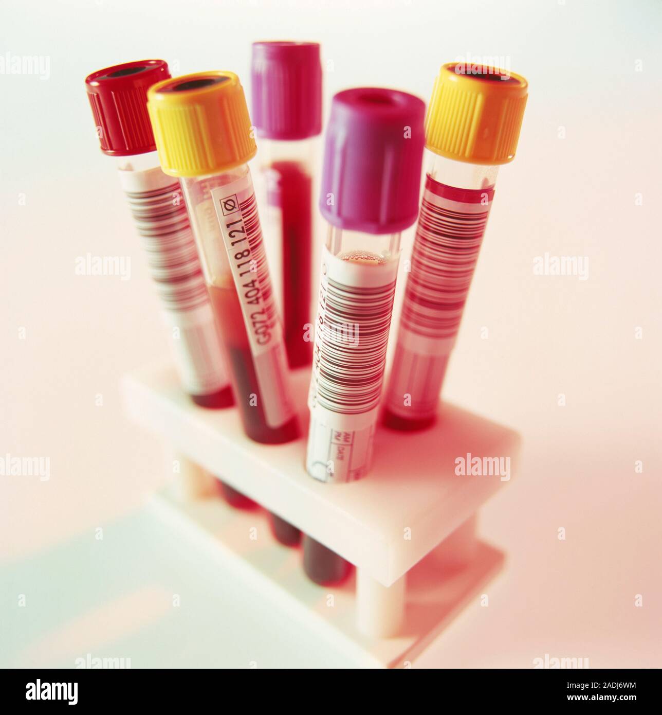 Blood sampling tubes. These are vacutainers (tubes containing a vacuum ...