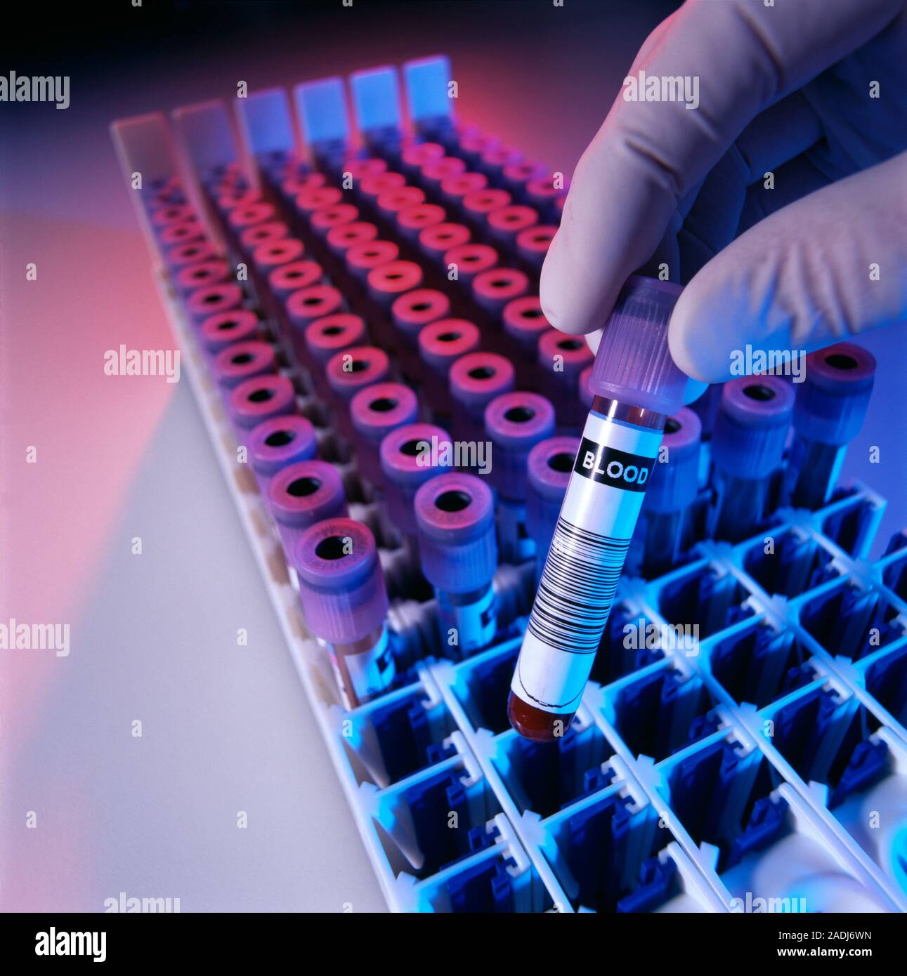 Blood sampling tubes. These are vacutainers (tubes containing a vacuum ...