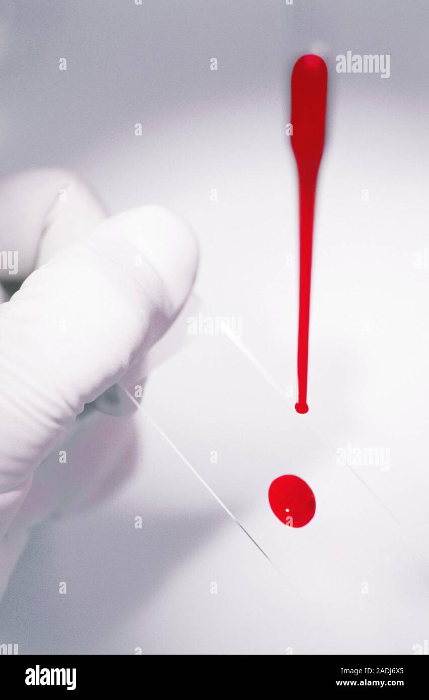 Dropping blood store