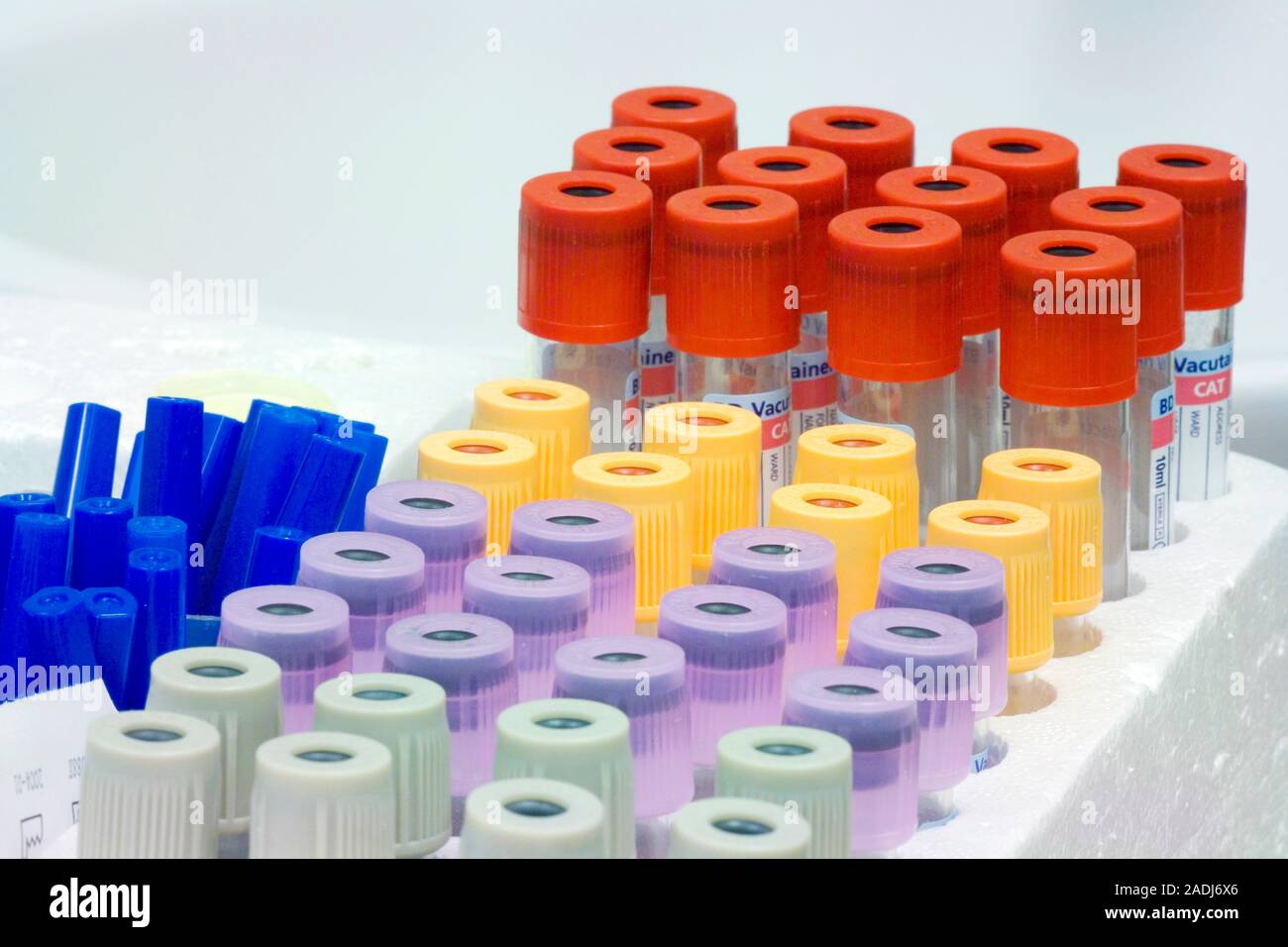 Blood samples in vacutainer tubes waiting to be analysed. The colour of ...