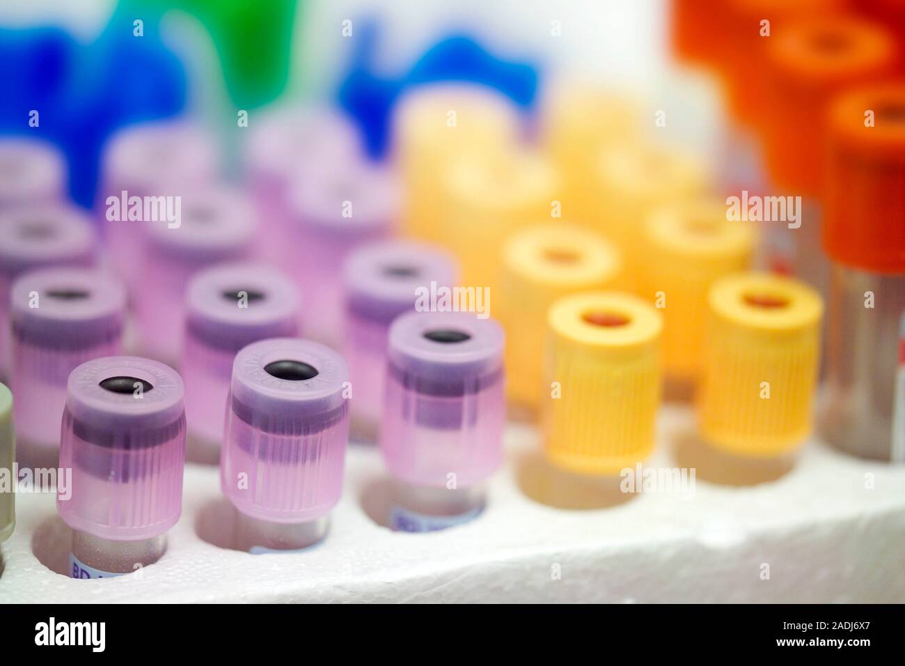 Blood samples in vacutainer tubes waiting to be analysed. The colour of ...