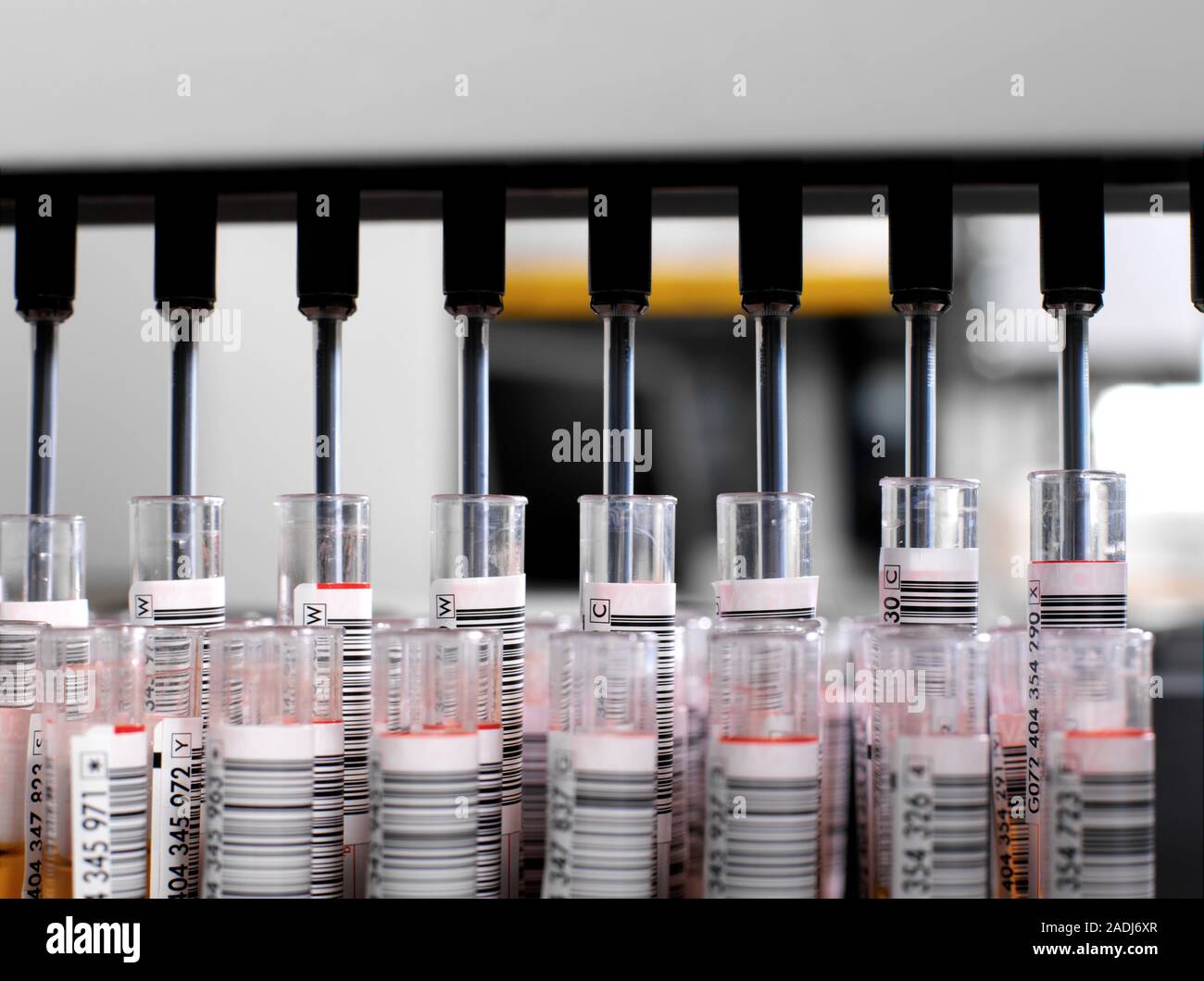 Blood analysis. Part of a machine for automated analysis of donated ...