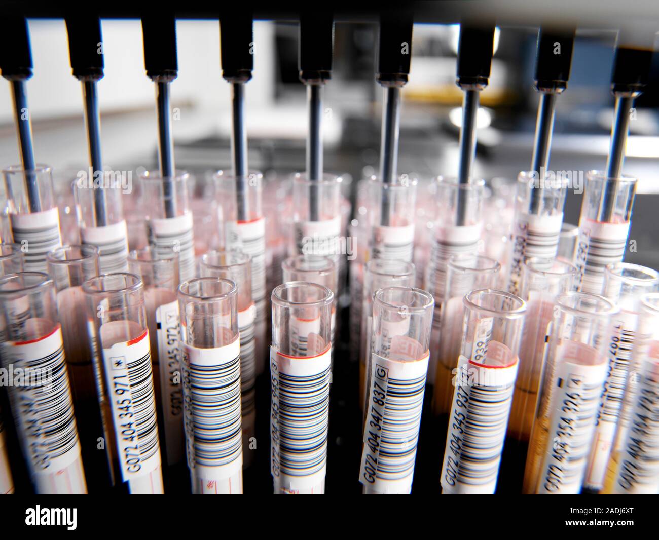 Blood analysis. Part of a machine for automated analysis of donated ...