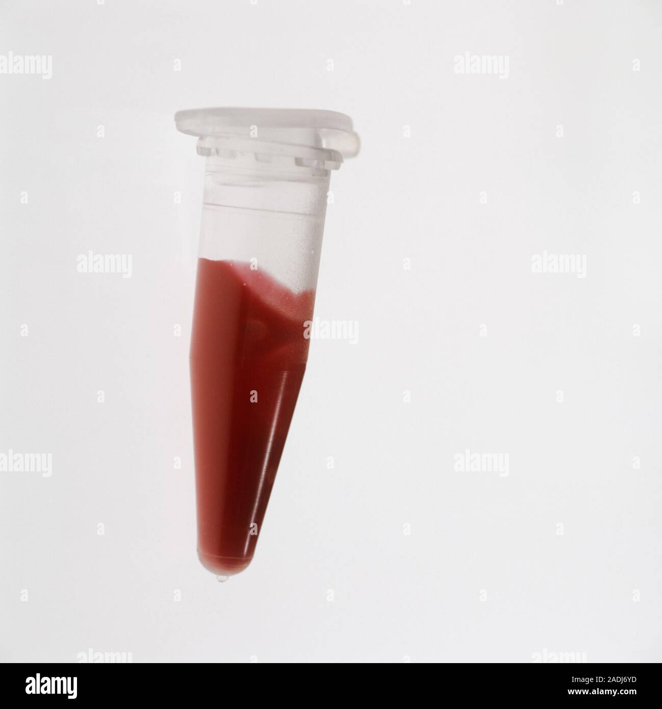 Blood sample. Blood-filled microtube. This small volume of blood has ...