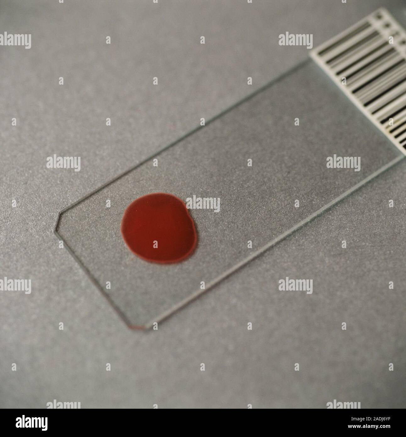Blood sample on a microscope slide. This drop of blood (lower left ...