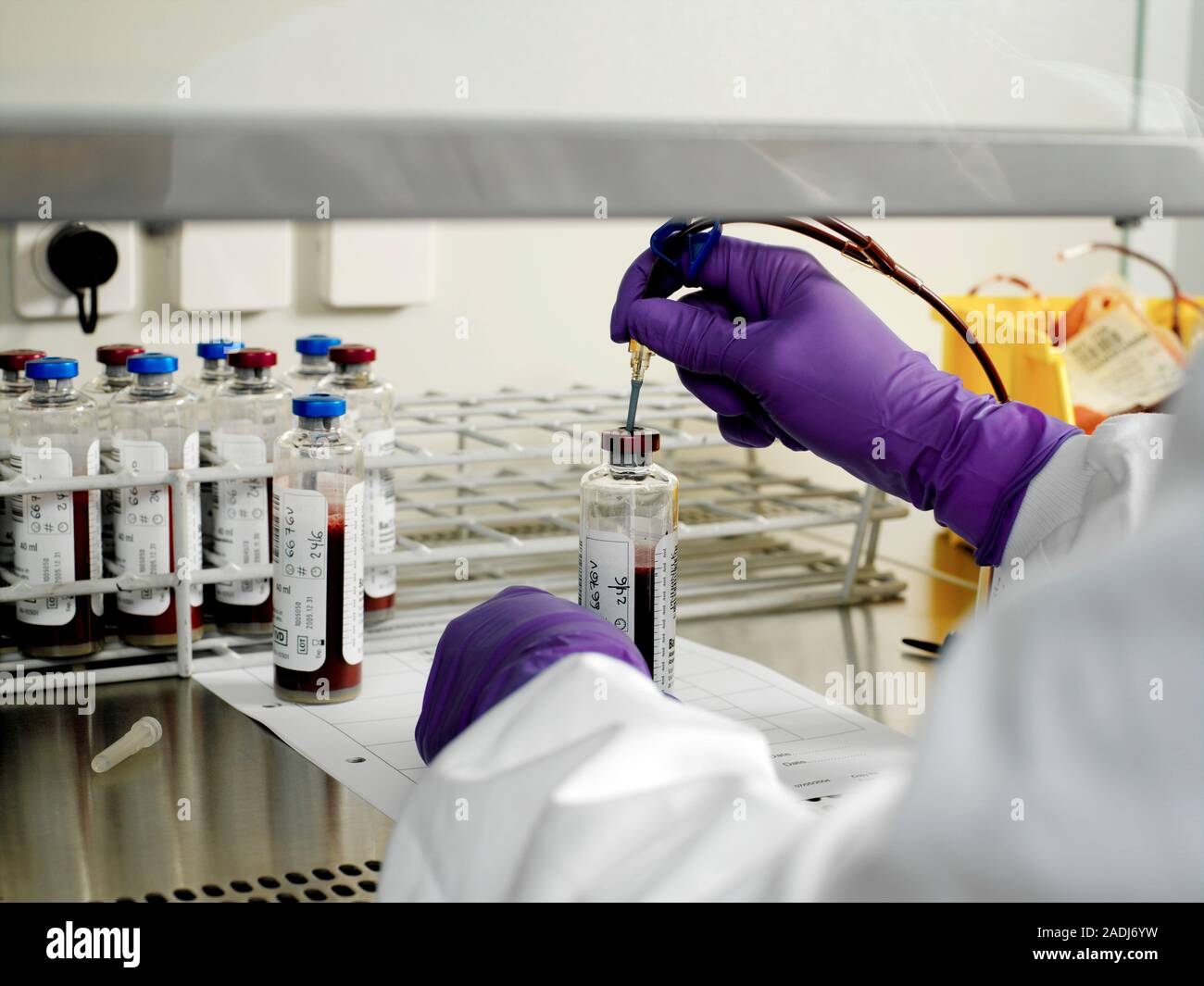 Testing donor blood for bacteria. Donor blood sample bottles being ...