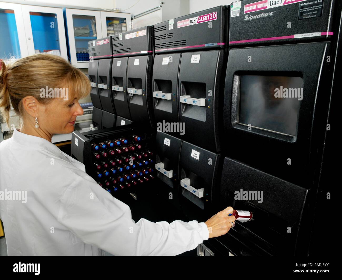 Testing donor blood for bacteria. Donor blood sample bottle being ...